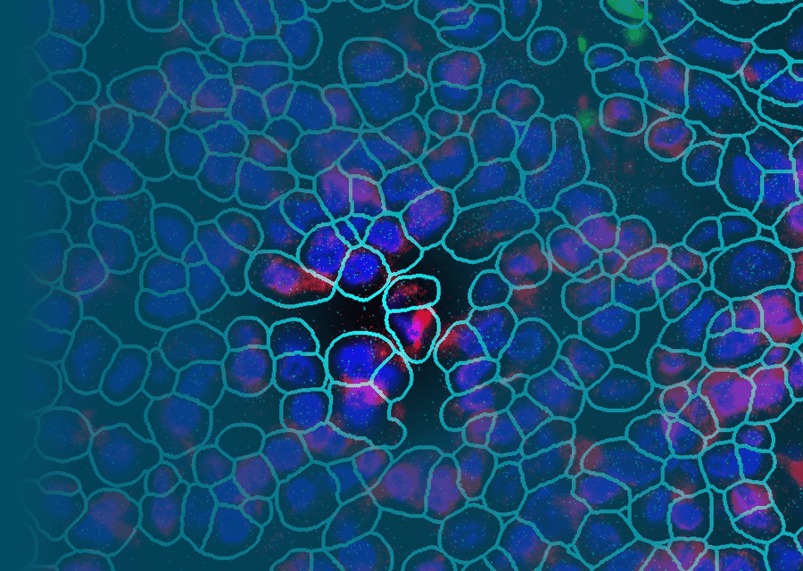 Spatial Multiomics Single-Cell Imaging Platform for FFPE Tissues