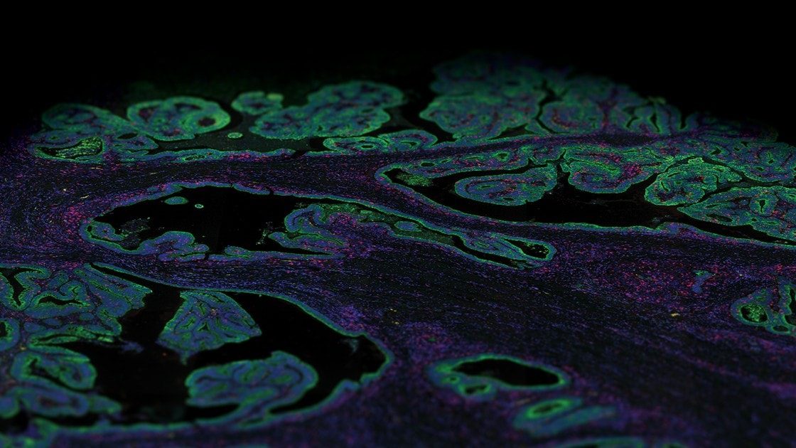 GeoMx Digital Spatial Profiler | Bruker Spatial Biology