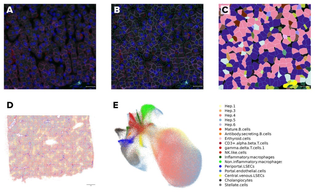 CosMx SMI Human Liver RNA FFPE Dataset | Bruker Spatial Biology