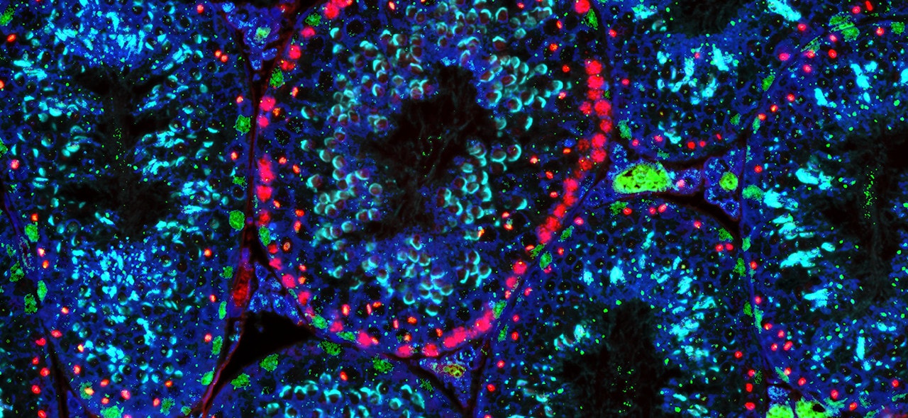 Cambridge Spatial Biology Happy Hour | Bruker Spatial Biology