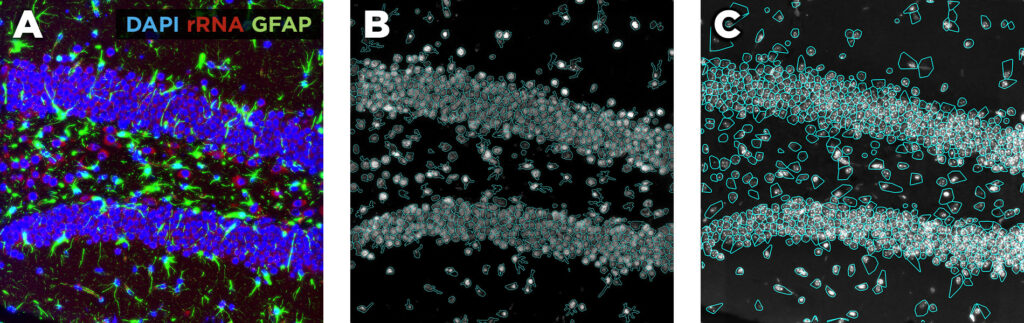 Complex Cell Segmentation and Its Significance in Spatial Biology