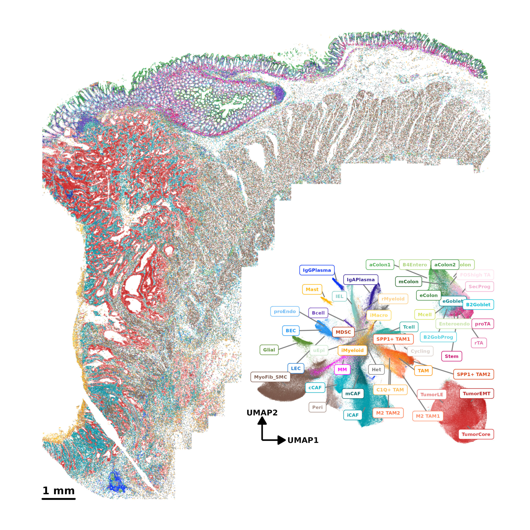 CosMx® Human Whole Transcriptome Colon Dataset | Bruker Spatial Biology