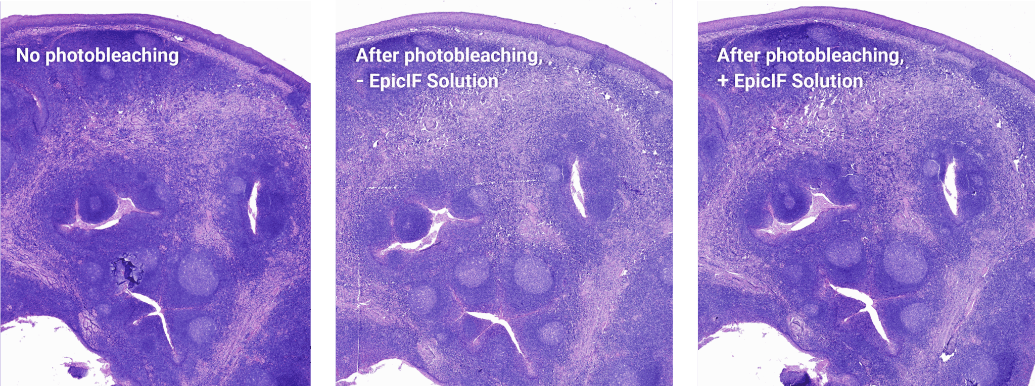 Introducing Enhanced Photobleaching in Cyclic Immunofluorescence for ...