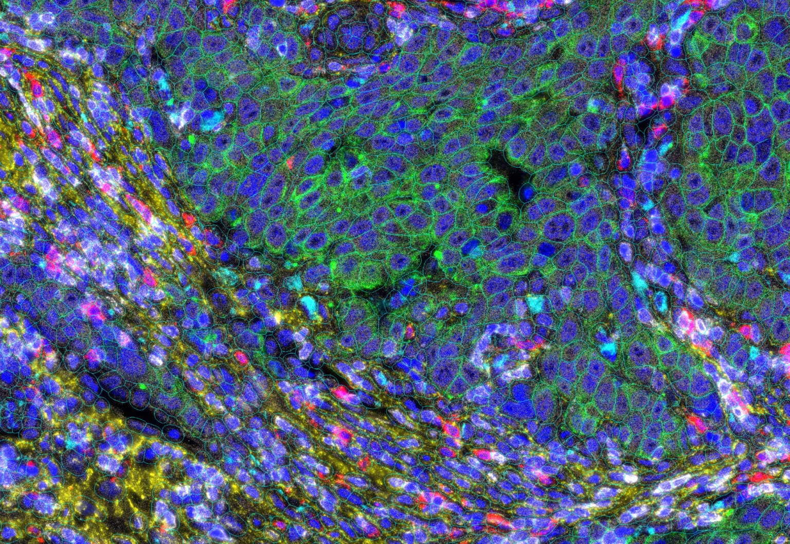 Why Transcriptomics Matters: Understanding the Value of High-Resolution ...