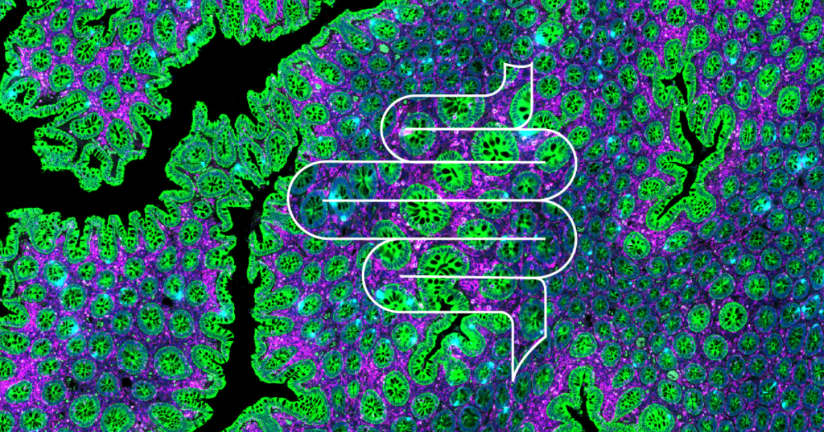 Human Liver | Bruker Spatial Biology