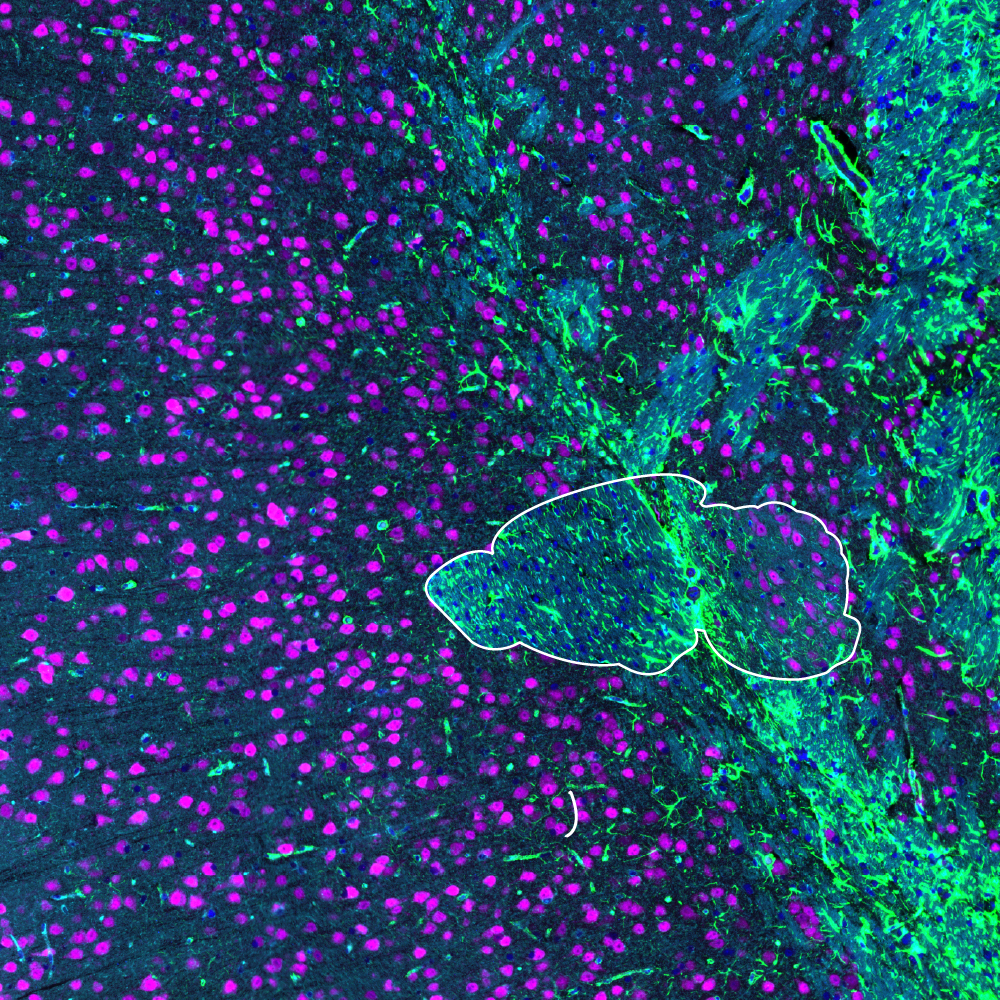 Mouse Brain | Bruker Spatial Biology