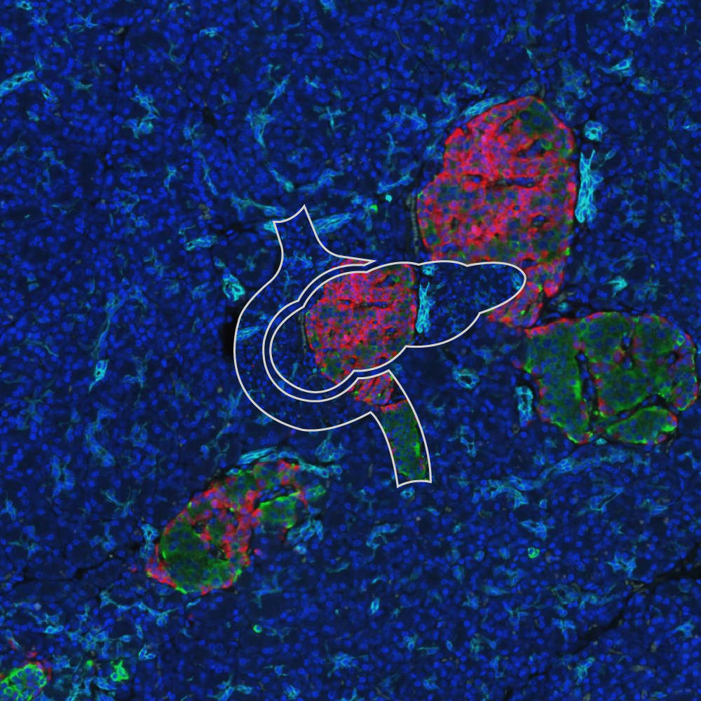 Human Pancreas | Bruker Spatial Biology